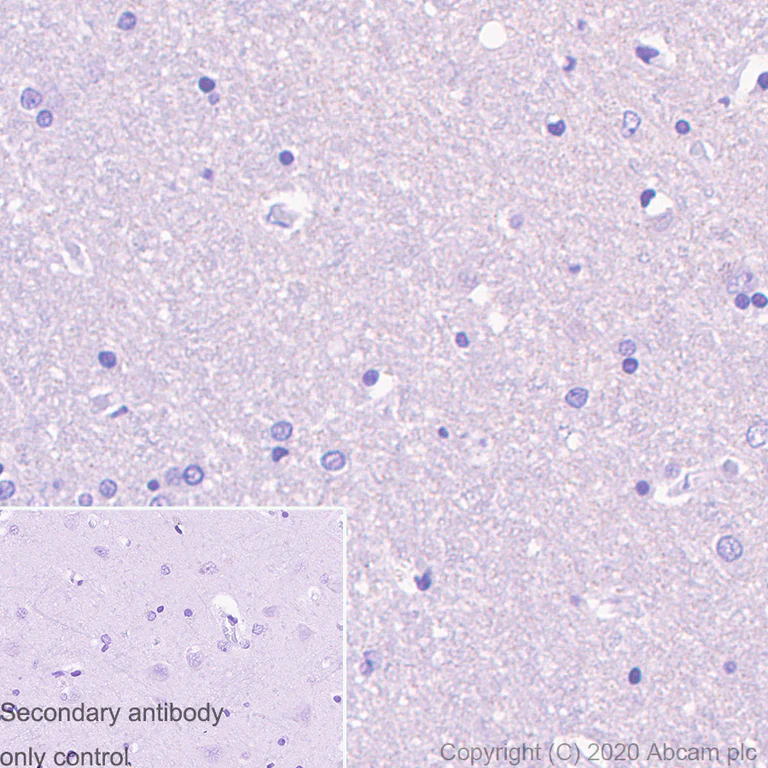Anti-Amyloid Precursor Protein 抗体 [7C8] - BSA and Azide free (ab273483)