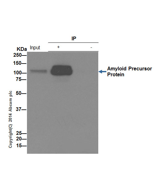 Anti-APP antibody [Y188] - recombinant (ab32136) | Abcam