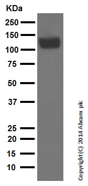 Anti-APP antibody [Y188] - recombinant (ab32136) | Abcam
