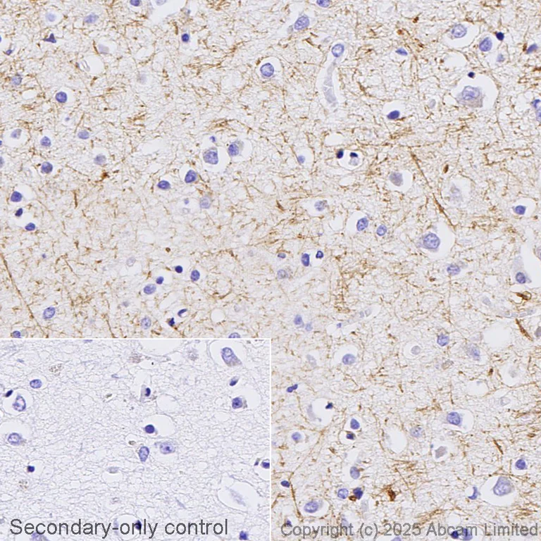 Anti-Amyloid Precursor Protein antibody [Y188] - Low endotoxin, Azide ...