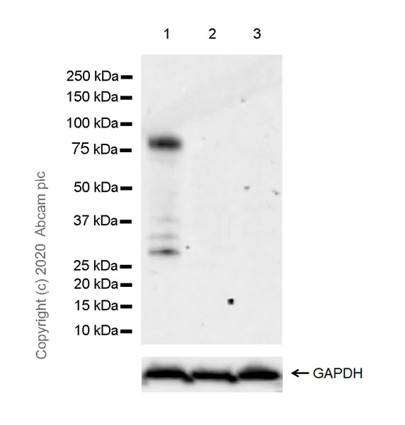 Anti-Androgen Receptor (AR-V7 specific) antibody [EPR15656-290 ...