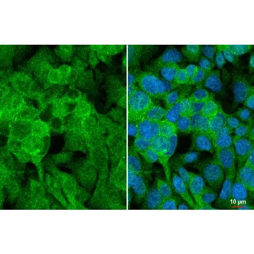 Anti-Angiogenin antibody [HL2214] (ab317164) | Abcam