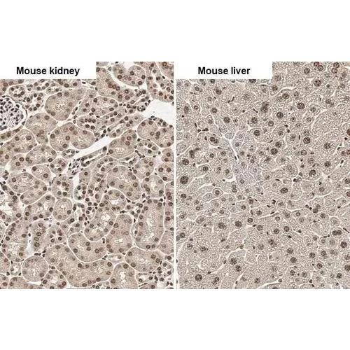 Anti-Angiogenin antibody [HL2214] (ab317164) | Abcam