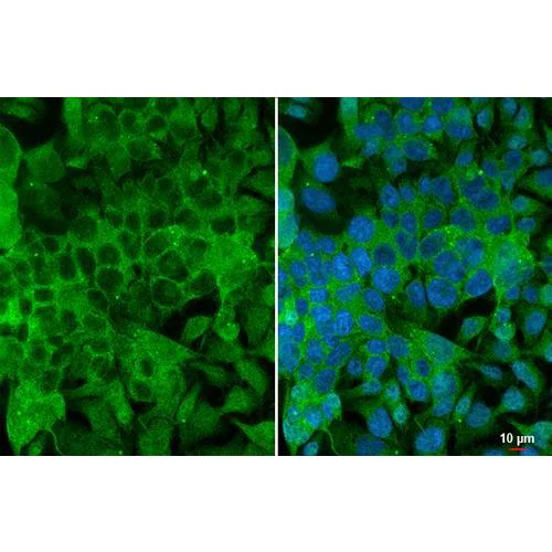 Anti-Angiogenin antibody [HL2215] (ab317165) | Abcam中文官网