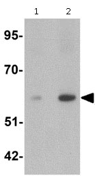 Anti-Angiopoietin 2/ANG2 antibody (ab125692) | Abcam