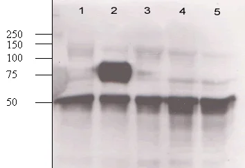 Anti-Angiopoietin 2/ANG2 antibody (ab8452) | Abcam
