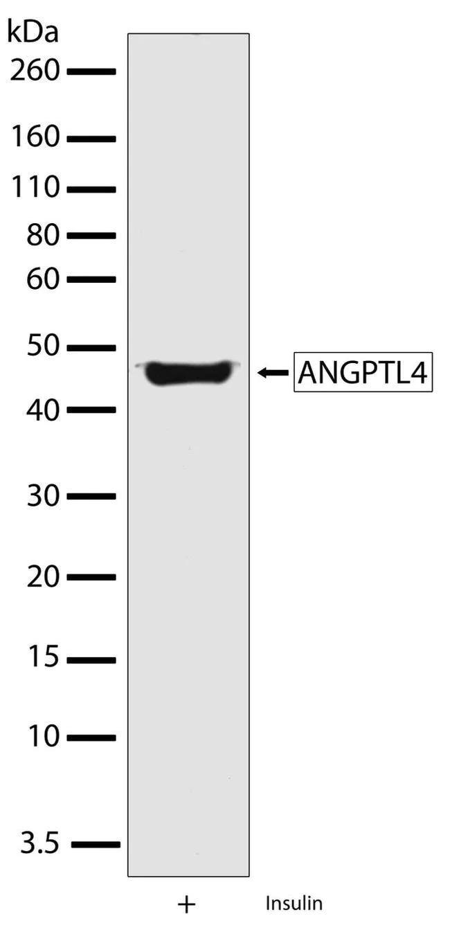 Anti-Angiopoietin-like 4/ANGPTL4 antibody [RP23040038] (ab308049) | Abcam