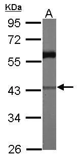 Anti-ANKRD1 antibody (ab272894) | Abcam