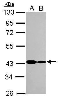 Anti-ANKRD1 antibody (ab272894) | Abcam