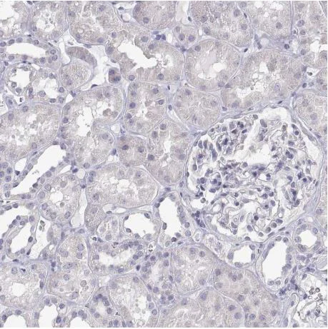 Ankyrin repeat domain-containing protein 65抗体 (ab204604)| Abcam中文官网