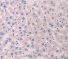 Anti-Antithrombin III/ATIII antibody (ab230981) | Abcam