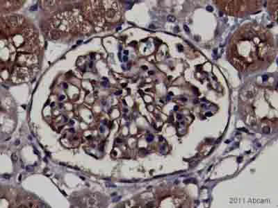 Anti-AP-A antibody (ab36122) | Abcam