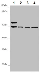Anti-AP1M1 antibody (ab230273) | Abcam