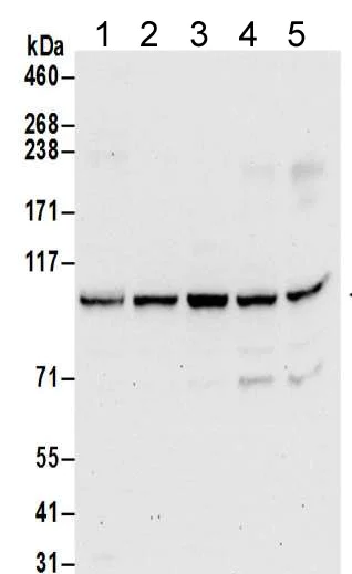Anti-AP2B1 antibody (ab205014) | Abcam