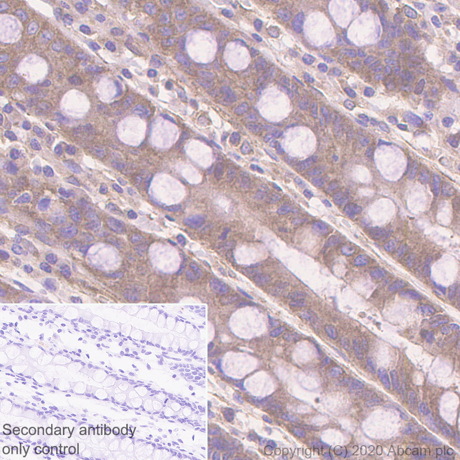 Anti-APC antibody [EP701Y] (ab40778) | Abcam