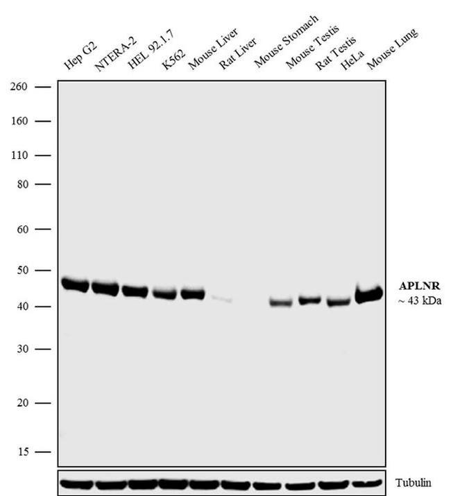 Anti-APJ Receptor antibody [RP23040146] (ab308018) | Abcam