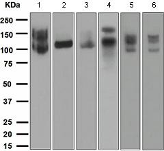 Anti-ApoER2 antibody [EPR3326] (ab108208) | Abcam