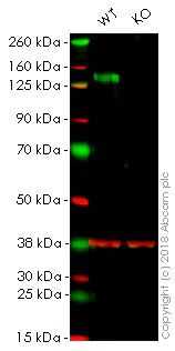ApoER2抗体[EPR3326] (ab108208)| Abcam中文官网