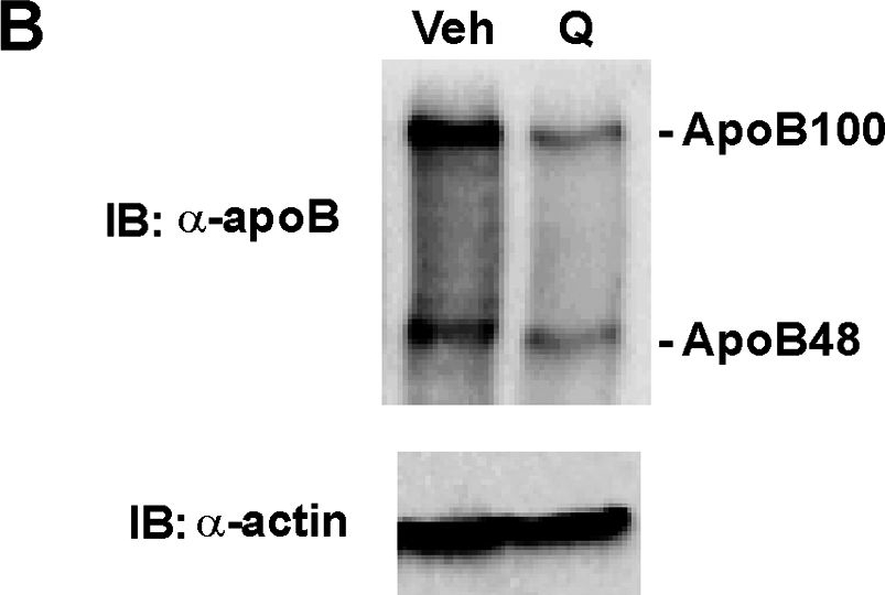 Apolipoprotein B抗体 (ab20737)| Abcam中文官网