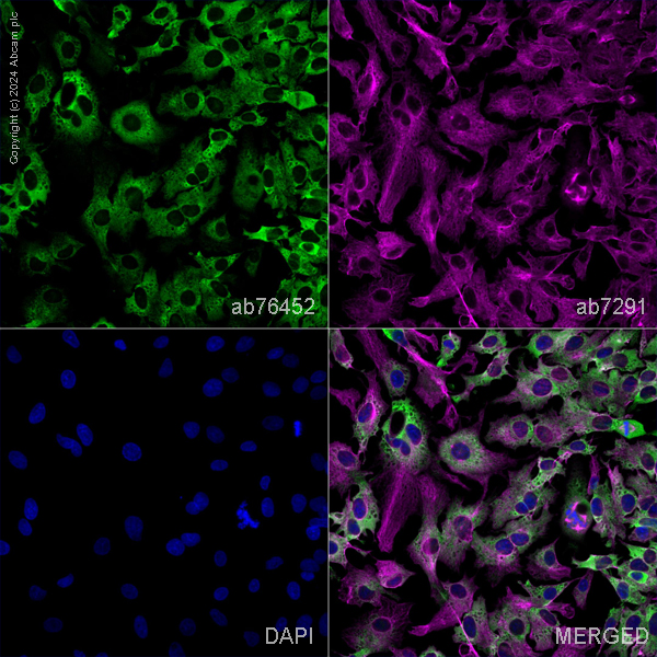 Anti-Apolipoprotein CII/ApoC-II antibody (ab76452) | Abcam