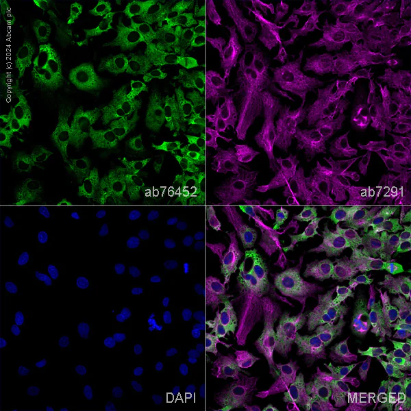 Apolipoprotein CII/ApoC-II抗体 (ab76452)| Abcam中文官网