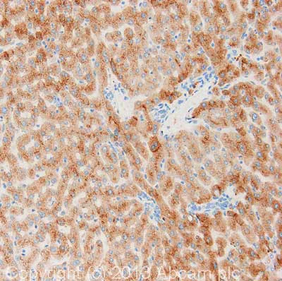 Apolipoprotein CII/ApoC-II抗体 (ab76452)| Abcam中文官网