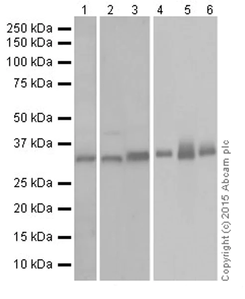 Anti-Apo-E antibody [EPR19392] - recombinant (ab183597) | Abcam