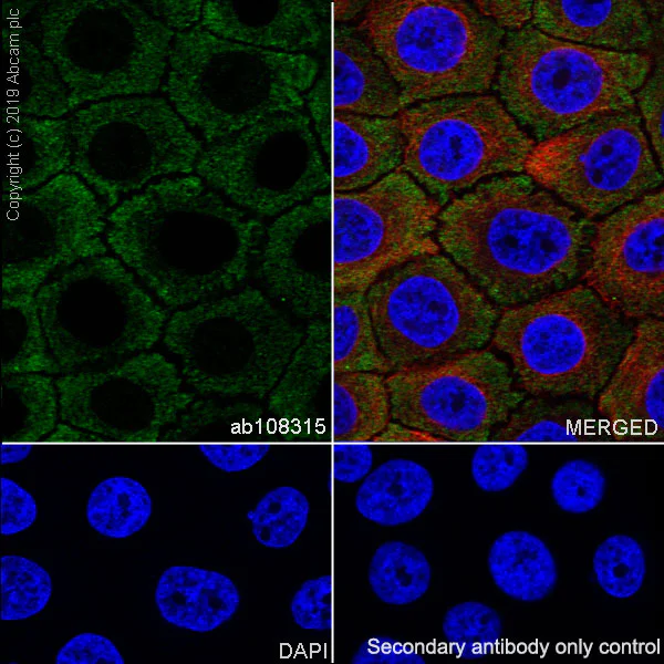 Anti-Apolipoprotein L1/APOL1 antibody [EPR2907(2)] (ab108315) | Abcam