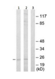 Anti-APRIL/TNFSF13 antibody (ab189263) | Abcam