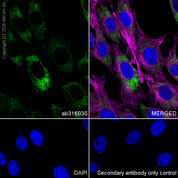 Anti-ARMET/ARP antibody [EPR29115-74] (ab316935) | Abcam