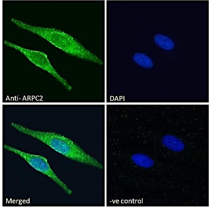 Anti-ARPC2 antibody (ab11798) | Abcam