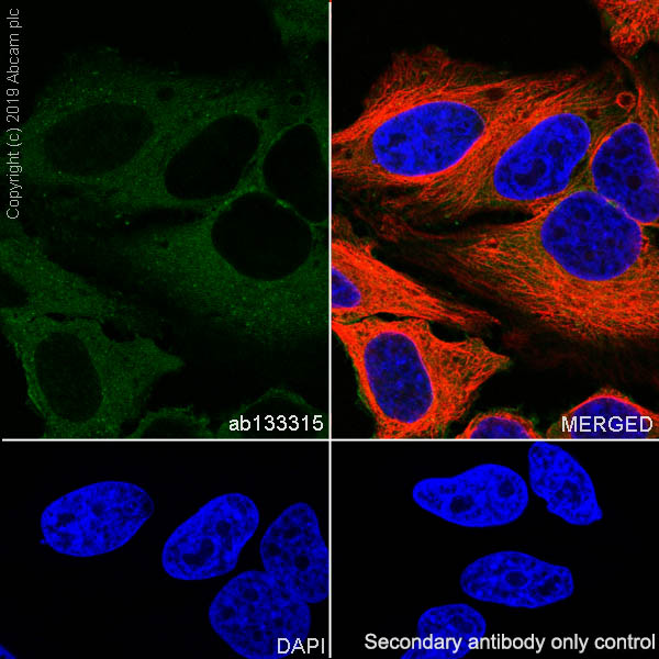 Anti-ARPC2 antibody [EPR8533] (ab133315) | Abcam