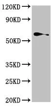 Anti-ASC1 antibody (ab236996) | Abcam