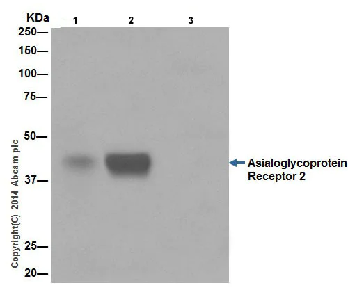 Anti-ASGR2 antibody [EPR16975] - BSA and Azide free (ab216521) | Abcam