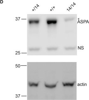 ASPA抗体 (ab97454)| Abcam中文官网