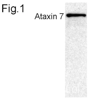 Anti-Ataxin 7 antibody (ab11434) | Abcam
