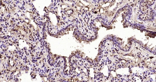 Anti-ATF-4 antibody (ab216839) | Abcam