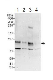 Anti-ATF6 antibody (ab134561) | Abcam