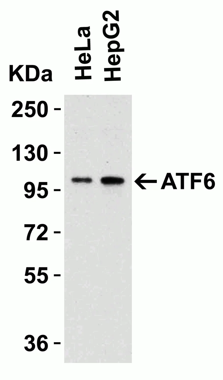 Anti-ATF6 antibody (ab37149) | Abcam