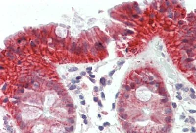 Anti-ATG2B antibody - N-terminal (ab189934) | Abcam