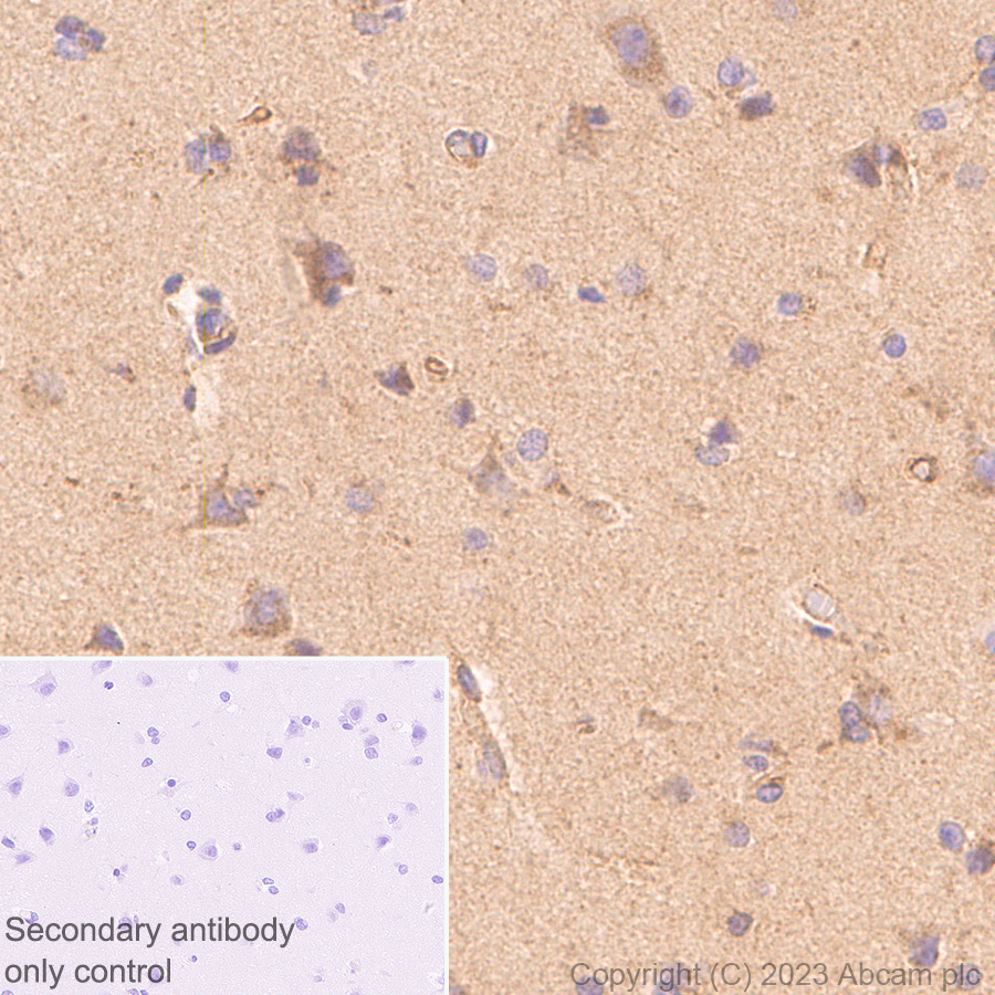 Anti-ATG9A antibody [EPR2450(2)] - Mouse IgG1 (Chimeric) (ab309518) | Abcam