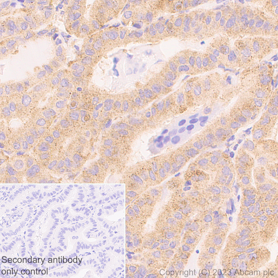 Anti-ATG9A antibody [EPR2450(2)] - Mouse IgG1 (Chimeric) (ab309518) | Abcam