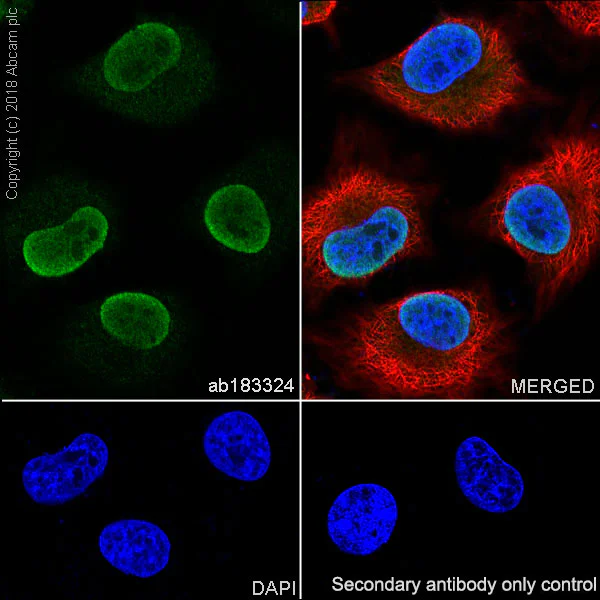 Anti-ATM antibody [SP224] (ab183324) | Abcam