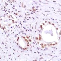 Anti-ATM antibody [SP224] - BSA and Azide free (ab213522) | Abcam