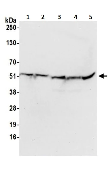 Anti-ATP5A antibody - Mitochondrial Marker (ab245581) | Abcam