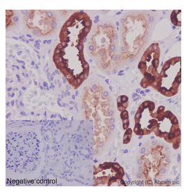 Anti-ATP6V1B1 antibody [EPR16400] (ab192612) | Abcam