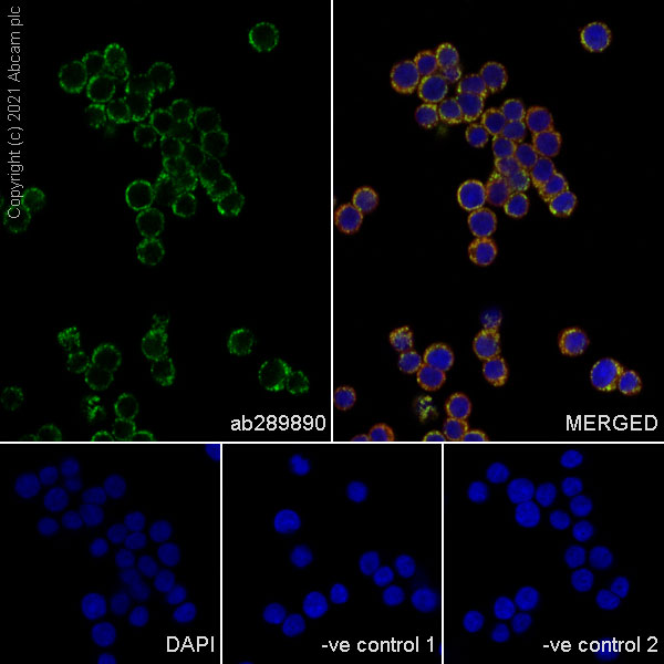 Anti-ATPB antibody [10/ATP] - Mitochondrial Marker (ab289890) | Abcam