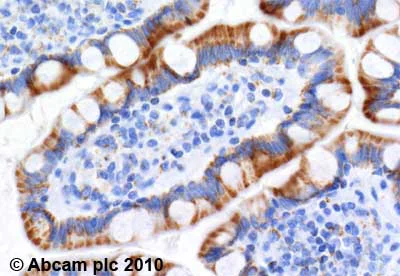 Anti-ATPB antibody [3D5] - Mitochondrial Marker (ab14730) | Abcam