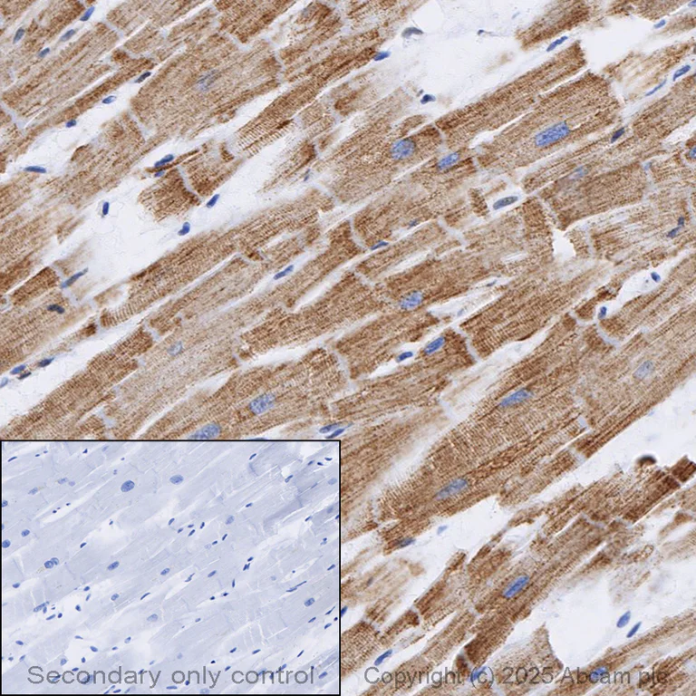Anti-ATPB 抗体 [3D5] - Mitochondrial Marker (ab14730) | Abcam