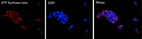 Anti-ATPB antibody [4.3E8.D10] - Mitochondrial Marker (ab5432) | Abcam
